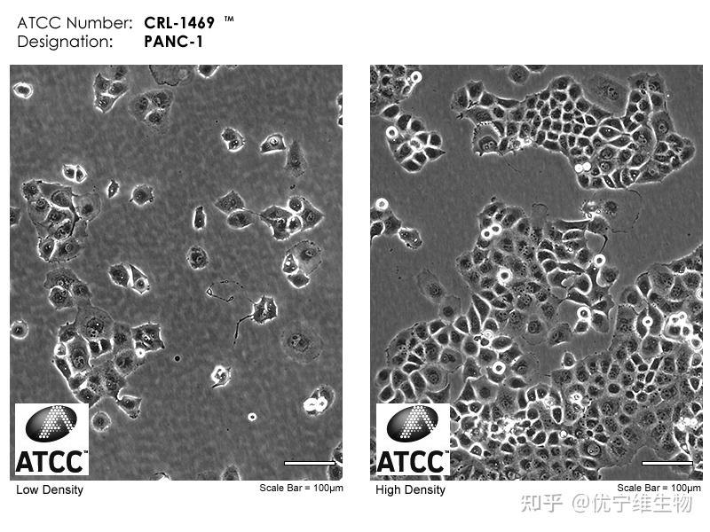 CFPAC-1、SW 1990、PANC-1、Panc02胰腺癌细胞系培养合集来袭！ - 知乎