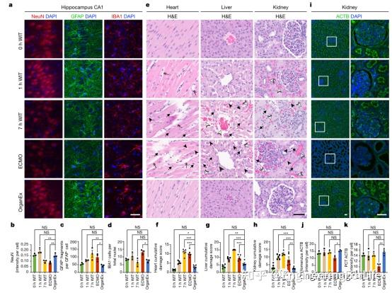 《Nature》重磅：继猪脑“复活”后的又一重大突破，OrganEx助力“起死回生” - 知乎