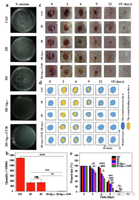 Chemical Engineering Journal: 具有原位生长的银金属有机框架的三维层状纳米纤维海绵用于促进伤口愈合 - 知乎