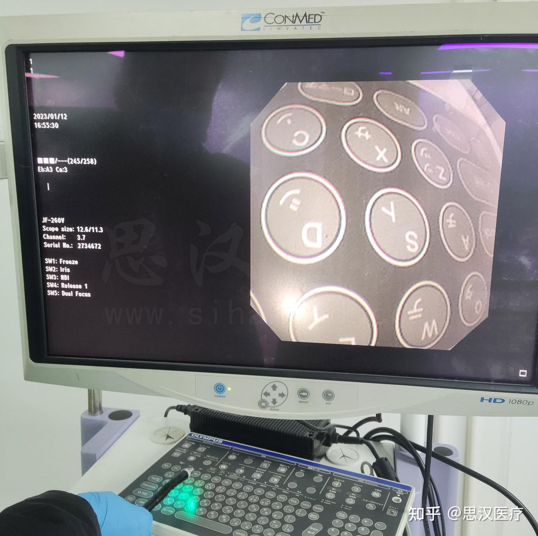 Olympus奥林巴斯 JF-260V 电子十二指肠镜橡皮破损漏水维修案例 - 知乎