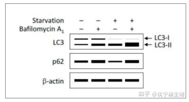 【小优细节君】细胞自噬标志物LC3检测要点，必看！ - 知乎