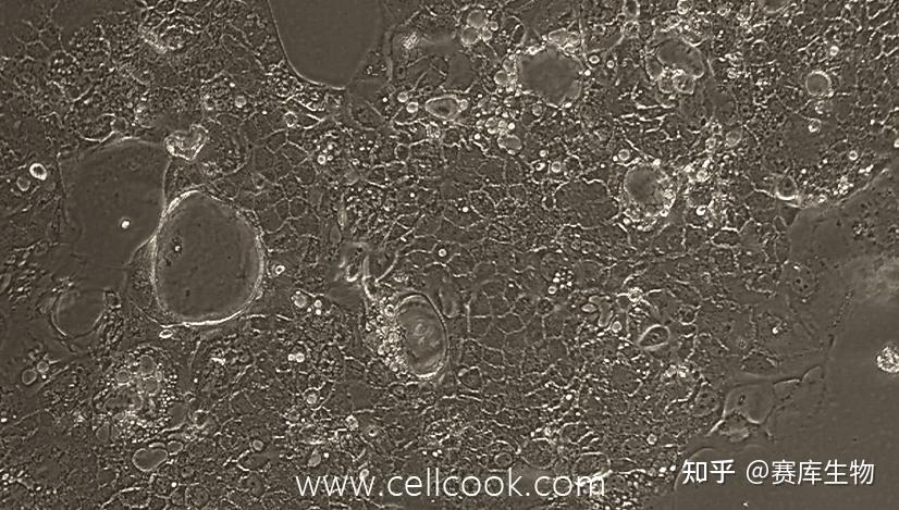 细胞学堂|Caco-2人结直肠腺癌细胞的生长特性及常见问题 - 知乎