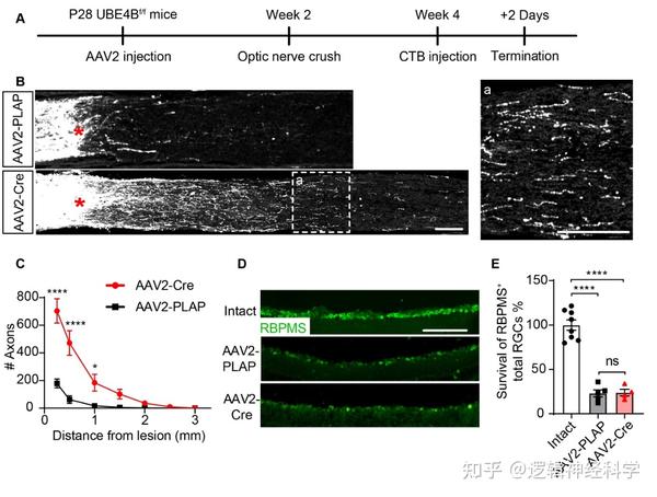 iScience︱浙江大学医学院王绪化/王志萍团队合作发现UBE4B有望成为卒中治疗新靶点：UBE4B下调促进卒中后中枢神经轴突再生和功能恢复 ...