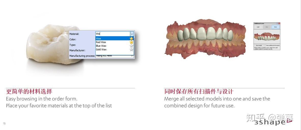 3shape 模型扫描仪 - 知乎