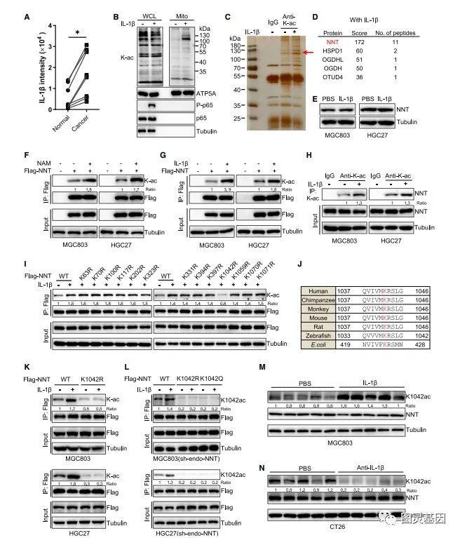 Mol Cell | 中山大学肿瘤医院徐瑞华团队发现 IL-1β诱导铁死亡机制 - 知乎
