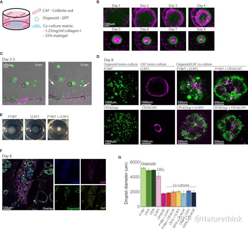 结肠癌细胞和肿瘤相关成纤维细胞的共培养可概括间充质型结肠癌的侵袭性特征 - 知乎