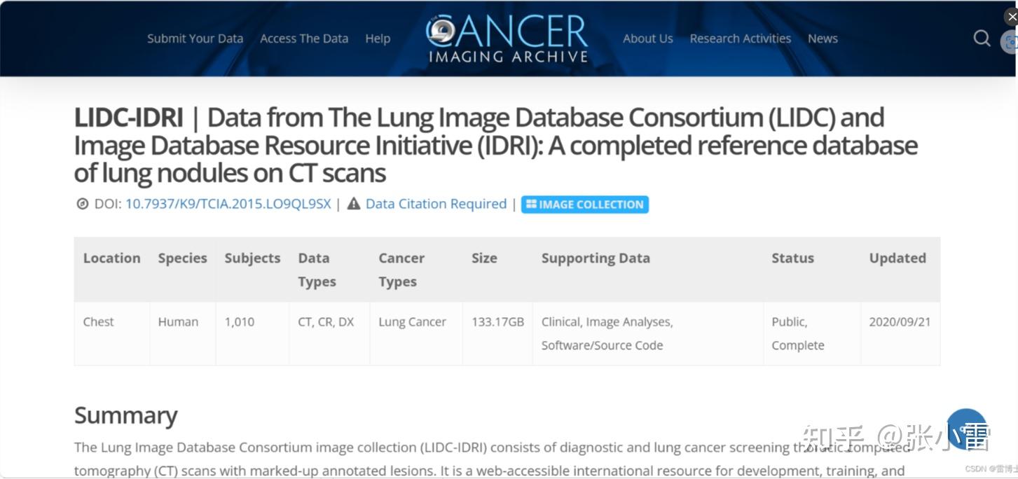 基于LIDC-IDRI肺结节肺癌数据集的放射组学深度学习分类良性和恶性肺癌（Python ）全流程解析 （一） - 知乎