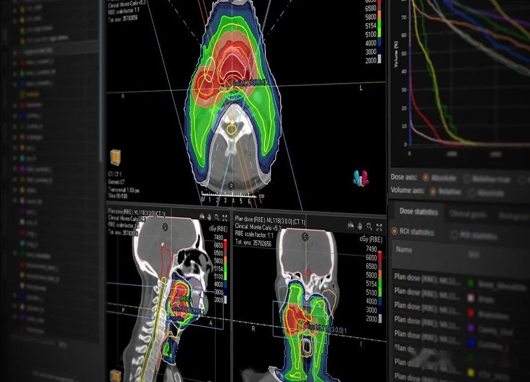 GE医疗：提升肿瘤诊疗效果，与RaySearch达成合作 - 知乎