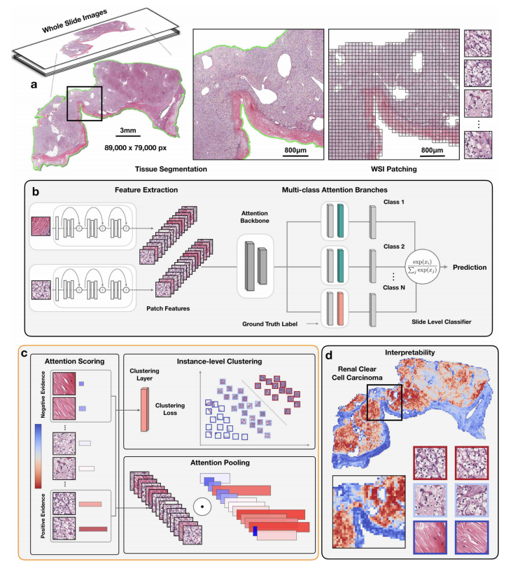 CLAM论文小阅 - 知乎