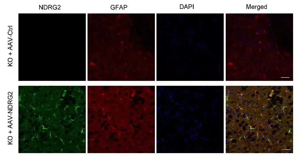 神经领域中「特异性启动子AAV」的妙用 - 知乎