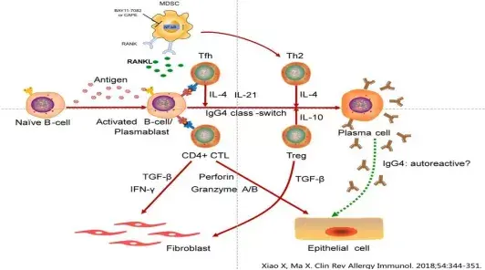 一文读懂新命名罕见病——IgG4 RD - 知乎