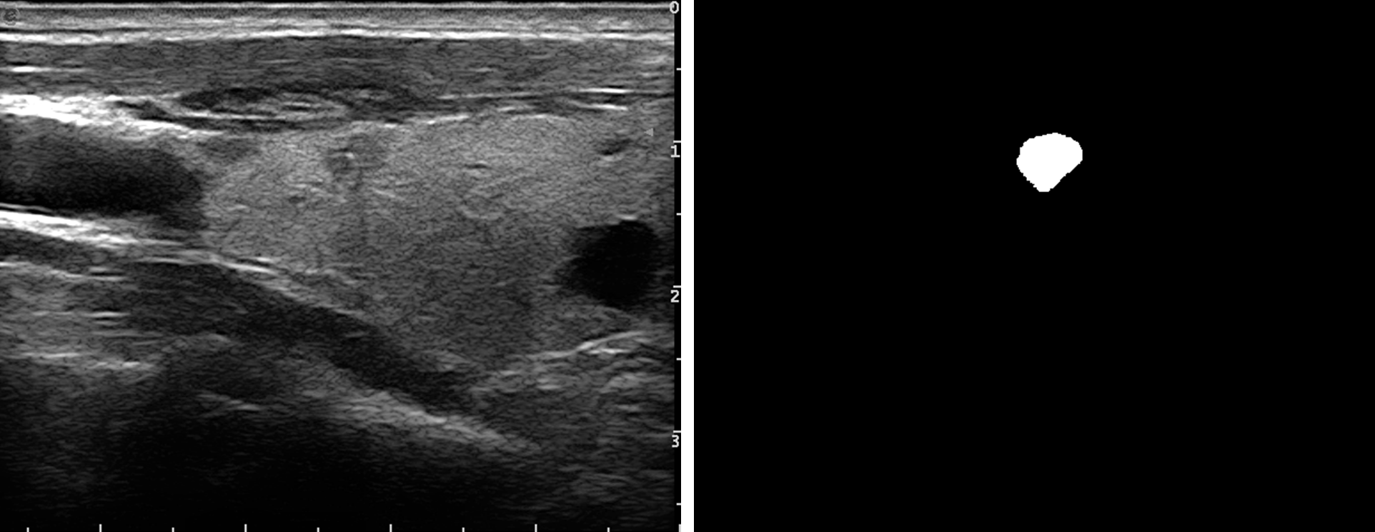 TN-SCUI 2020 数据集介绍 - 知乎