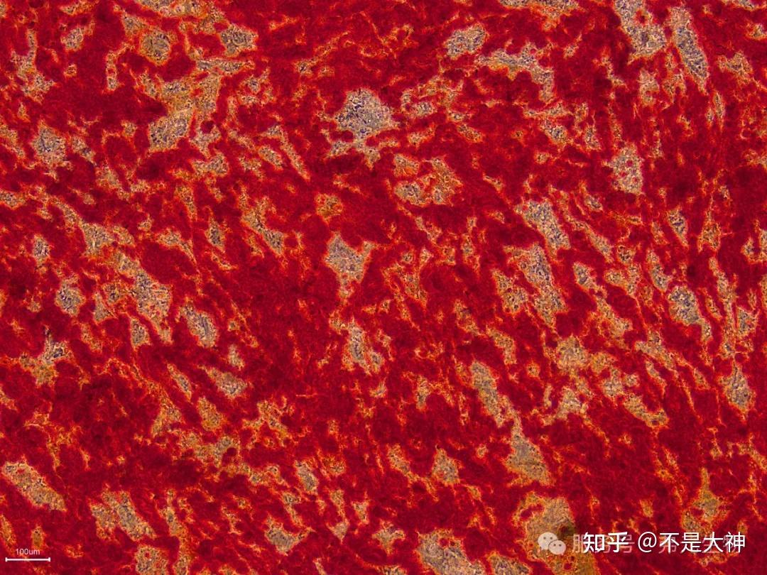 间充质干细胞成骨诱导鉴定之标志物检测 - 知乎