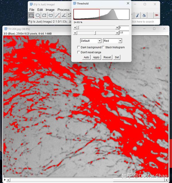 组化片子如何利用Image J 进行阳性信号面积占比统计分析 - 知乎