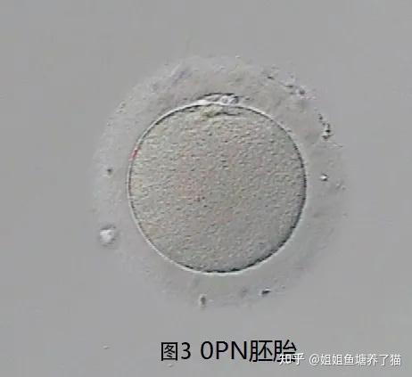 试管婴儿：胚胎受精情况解读 - 知乎