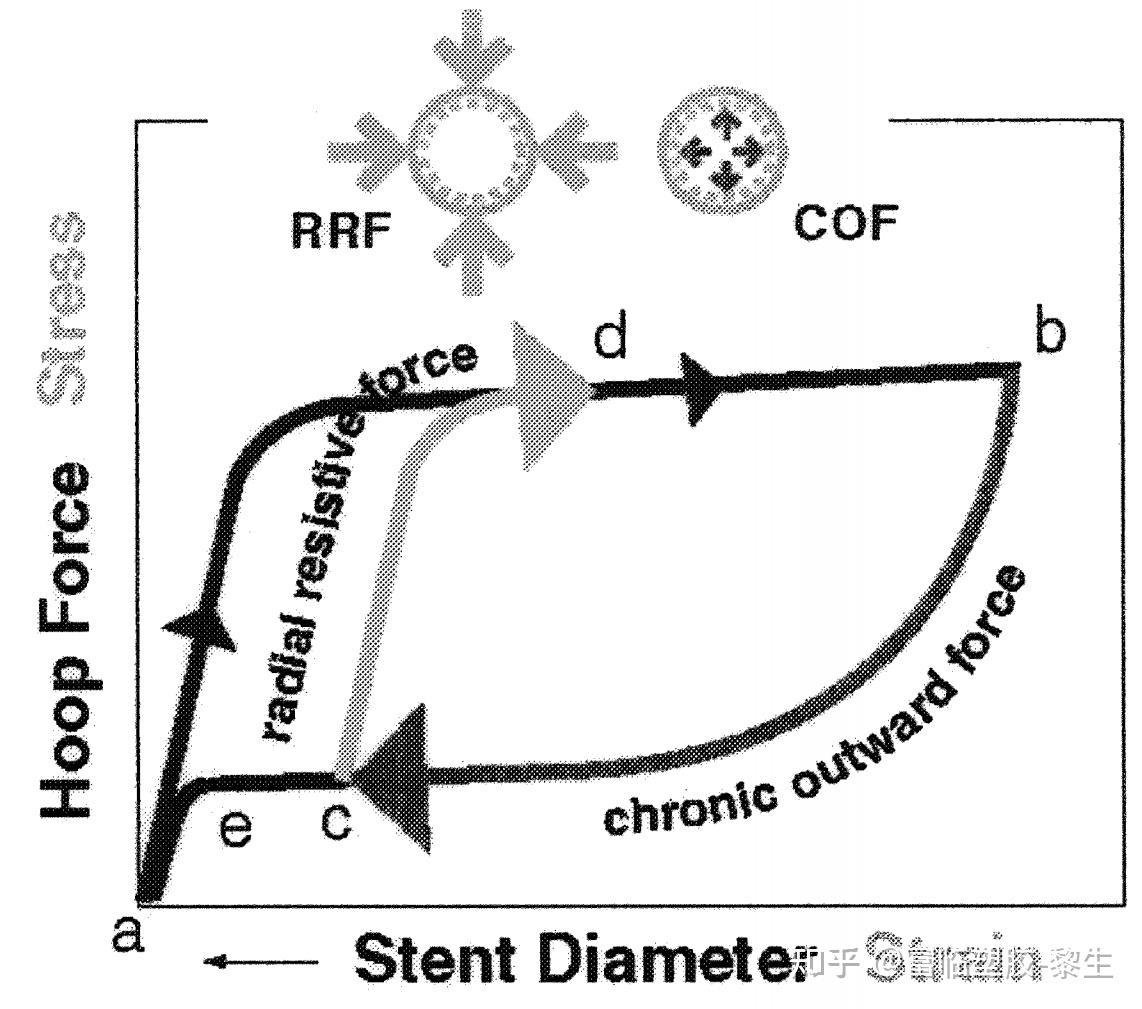SMA形状记忆合金 - 在三类医疗器械中的应用 - 知乎