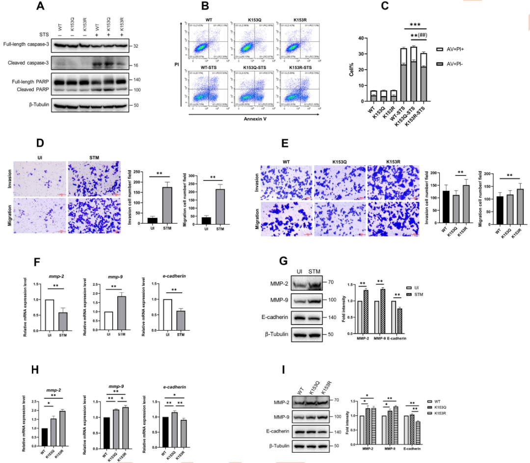PLoS Pathog︱上海交通大学姚玉峰/卢捷课题组合作发现病原菌可通过调节宿主CDC42乙酰化修饰促进结直肠癌发生发展 - 知乎
