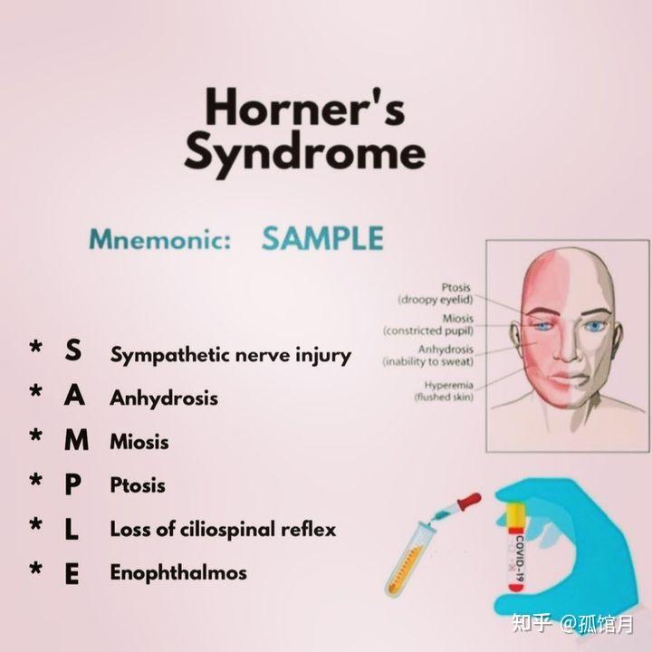 霍纳综合征（Horner's Syndrome） - 知乎