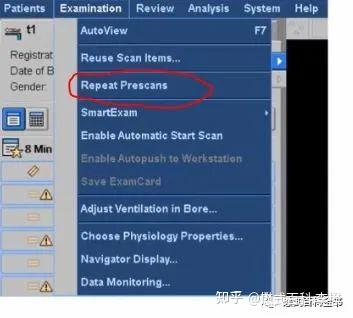 磁共振中非常重要但是又看不到的预扫描Pre-scan - 知乎