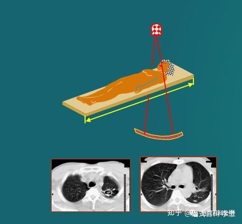 什么是CBCT？它和CT有什么区别？ - 知乎