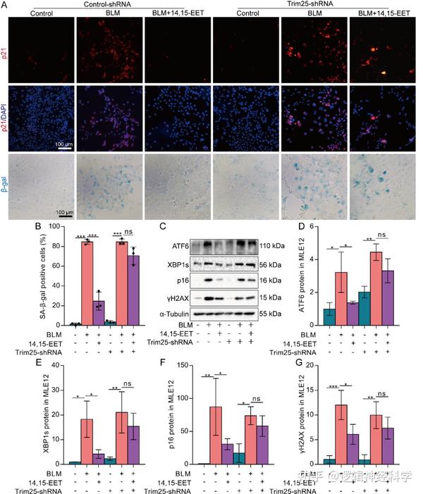 Redox Biol︱中南大学管茶香团队揭示抗肺衰老新机制 - 知乎