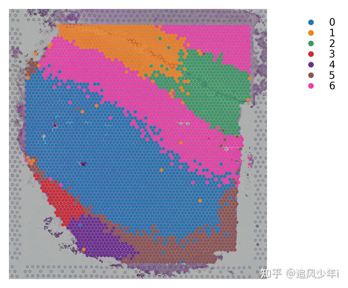 10X单细胞空间回顾之stlearn - 知乎