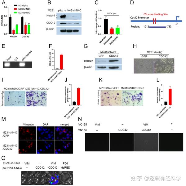 贵州医科大学豆晓伟团队揭示沉默Notch4促进三阴性乳腺癌成瘤和抑制转移作用及机制 - 知乎