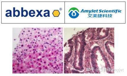 艾美捷Abbexa AEC 色原试剂盒使用说明 - 知乎
