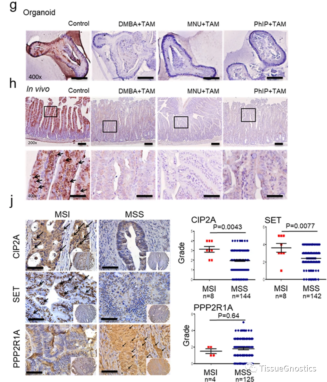 Nature Communications|蛋白磷酸酶2A（PP2A）或将成为肿瘤生物标志物“新宠” - 知乎