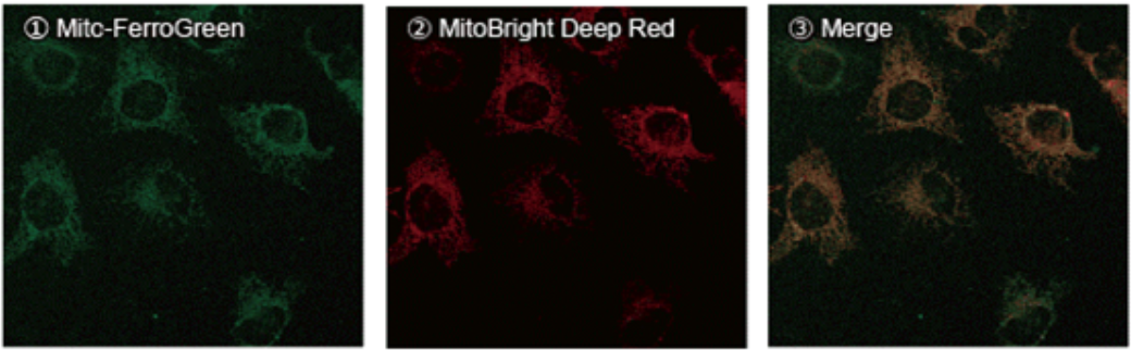 铁死亡与线粒体 - 知乎