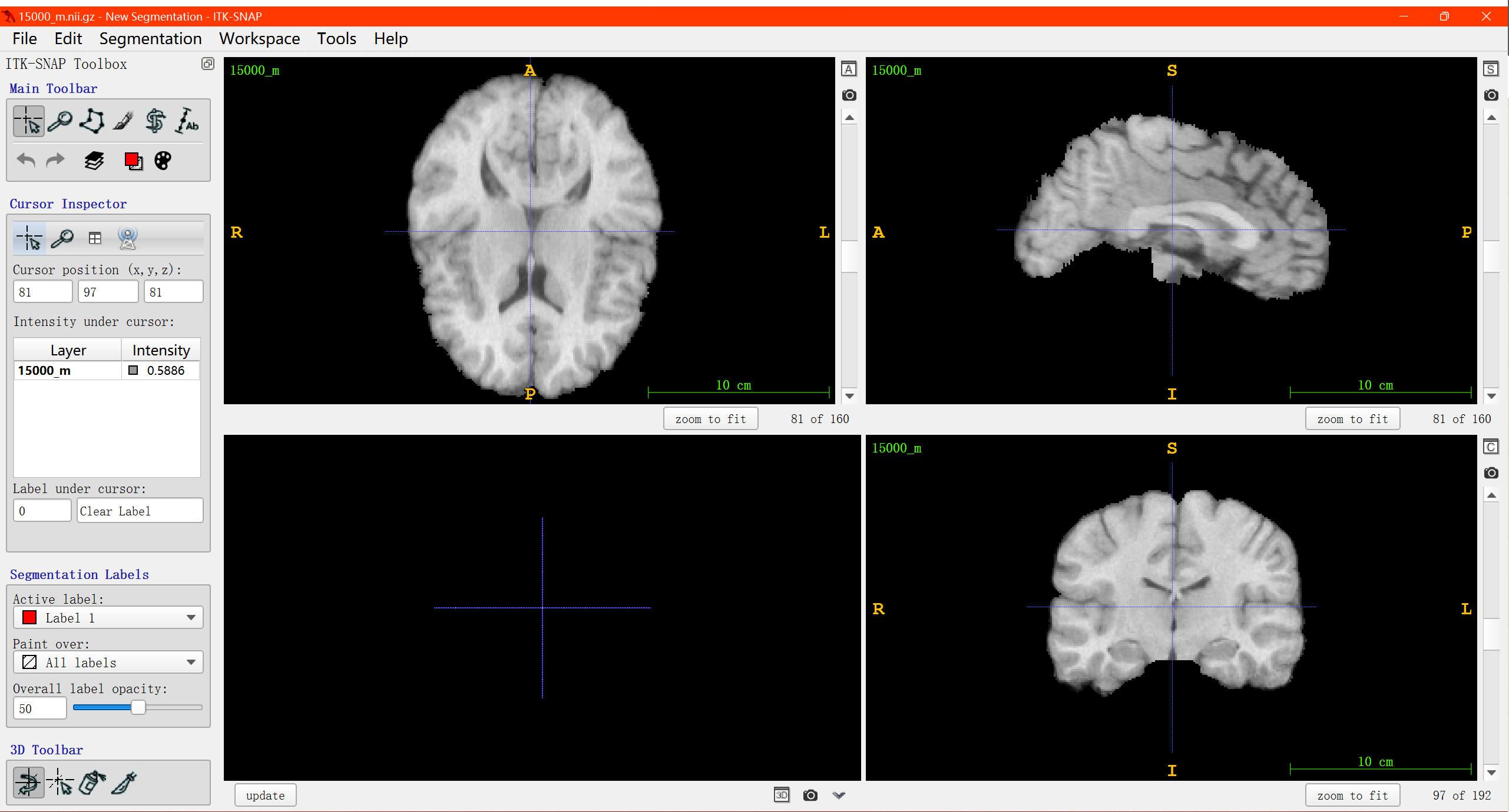 [论文笔记] VoxelMorph - 知乎