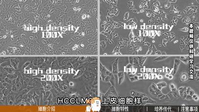 HCCLM3细胞培养，人高转移肝癌细胞培养攻略-丰晖生物 - 知乎