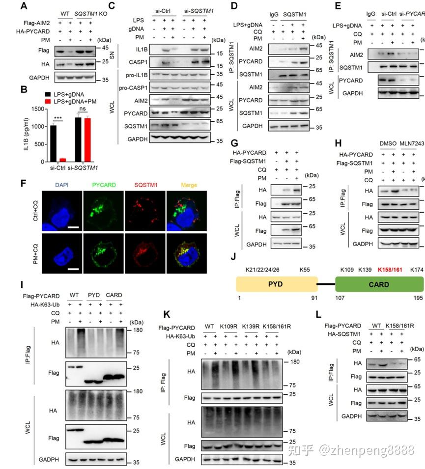 扁蒴藤素通过选择性自噬调节AIM2-PYCARD/ASC的稳定性来抑制AIM2炎症小体缓解肌腱病 - 知乎