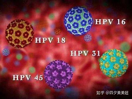 体检时查的HPV宫颈癌筛查，你了解多少？ - 知乎