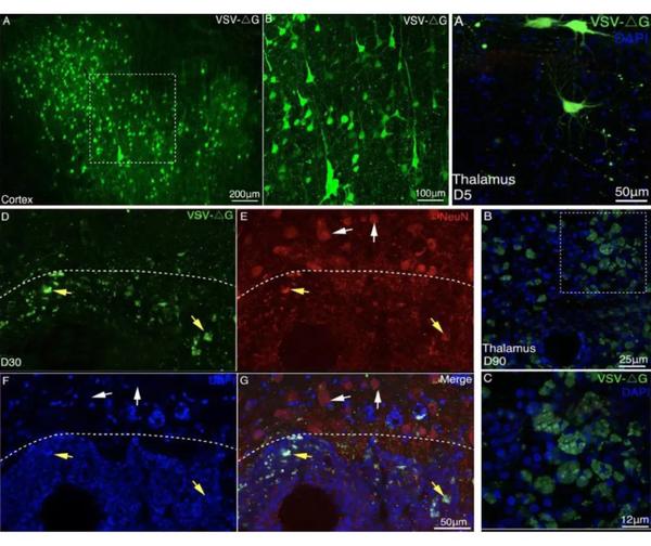AAV、VSV和 LV在猕猴上的应用 - 知乎
