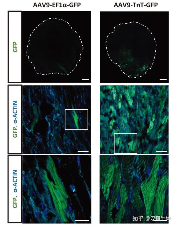 【心血管干货篇】AAV在心血管疾病研究中的靶向策略 - 知乎