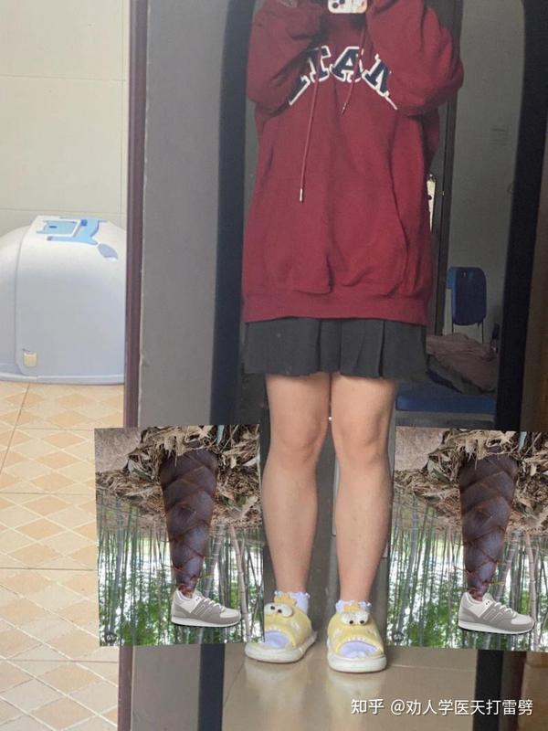 瘦腿霜是真的有效还是智商税?!如何在两个月内快速瘦腿? 知乎