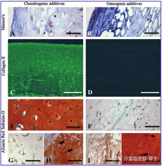 PGA Biofelt植入级无纺布 研究结果表明，长期培养这些结构会导致肥大性软骨细胞表型 - 知乎