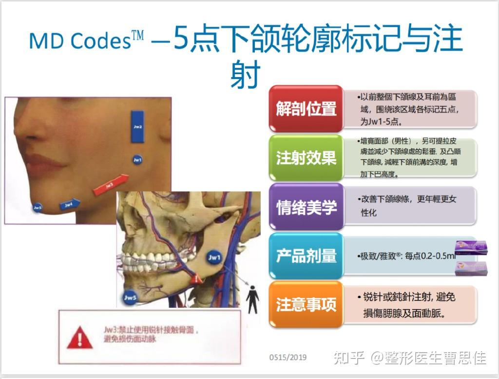 MD Codes 注射法，我为什么不教！ - 知乎