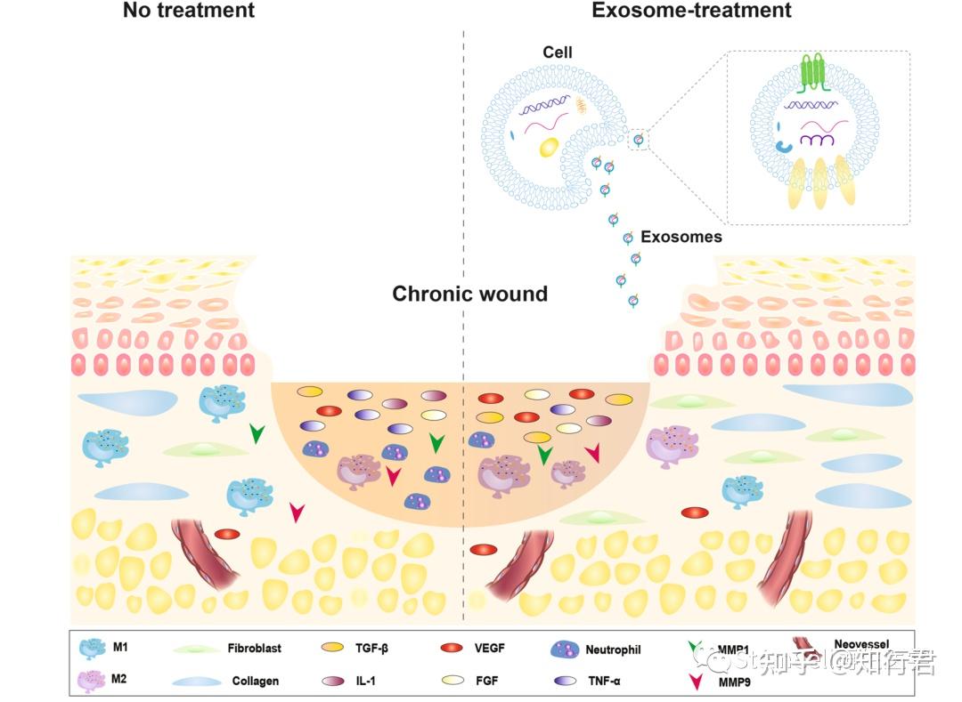 间充质干细胞外泌体：临床应用前景可期 - 知乎