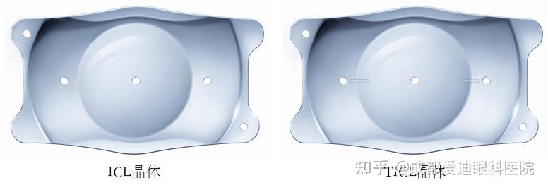 近视手术攻略-ICL晶体植入术篇 - 知乎