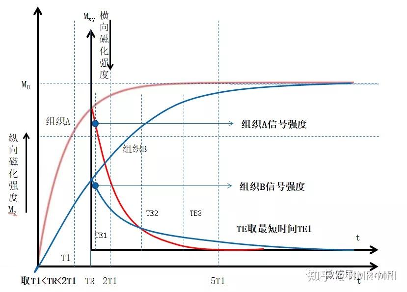 磁共振成像：对PDW T1W T2W 三种加权图像的理解 - 知乎