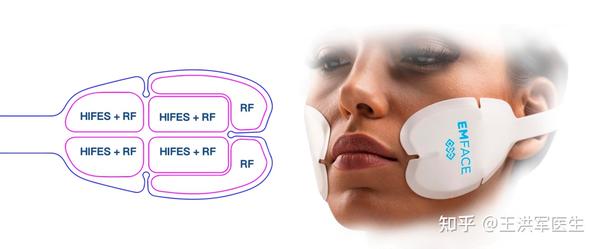 风靡欧美的面部肌肉抗衰黑科技-BTL EMface美菲斯 - 知乎