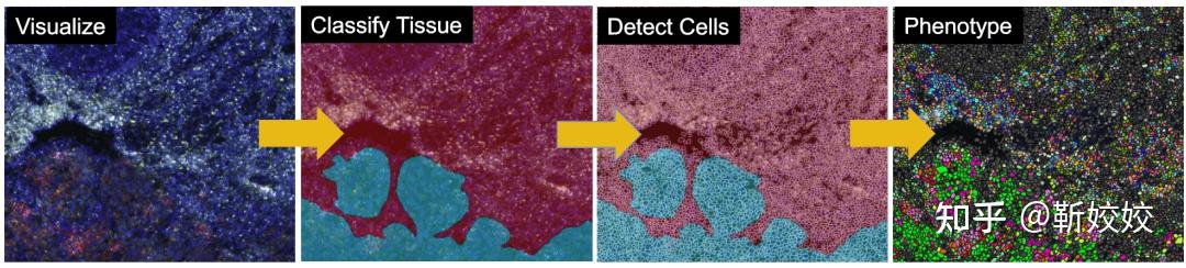 Visiopharm数字病理分析软件助力空间多组学分析肿瘤免疫微环境 - 知乎