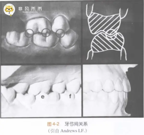 『正畸科普』Andrews六要素 - 知乎