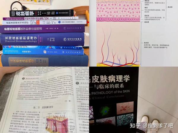 从医学上的角度来讲,黑头到底能不能去掉?该怎么做? 知乎