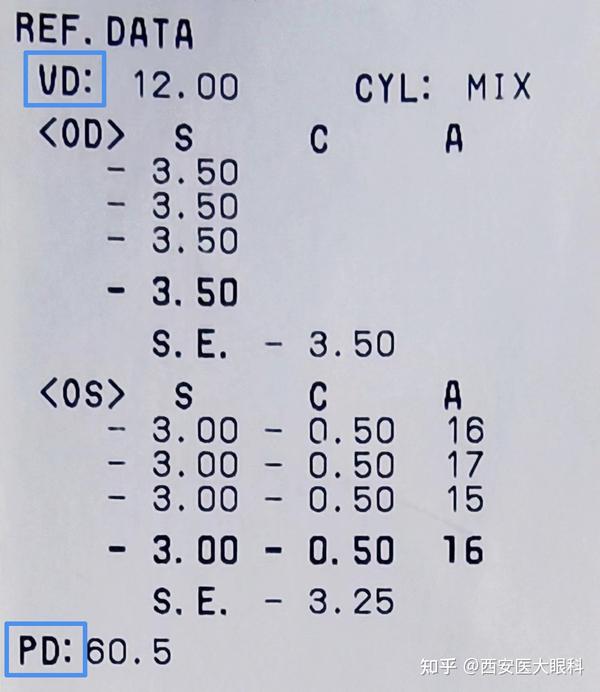 手把手教你看懂电脑验光单，建议收藏 - 知乎
