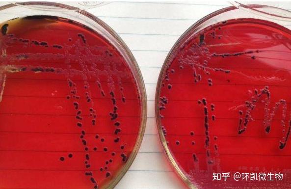 GB4789.4-2016沙门氏菌的检验过程及操作时的注意事项 - 知乎