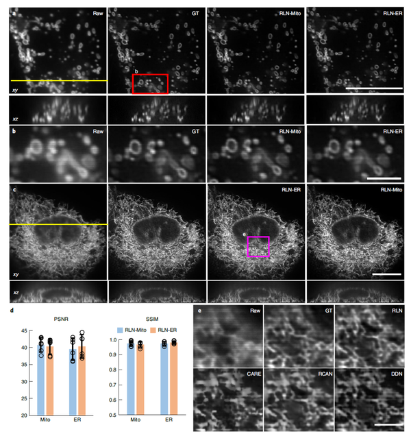 Nature Methods | 基于AI的快速超分辨率显微镜技术 - 知乎