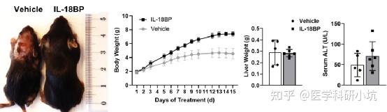 Hepatology: IL-18信号通路促进小鼠肝纤维化中肝星状细胞的激活 - 知乎